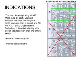 Percutaneous pinning of distal radius (old technique) | PDF