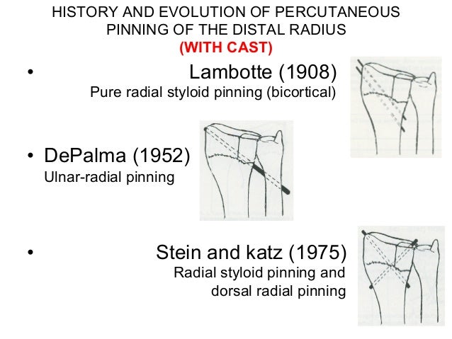 Percutaneous Pinning