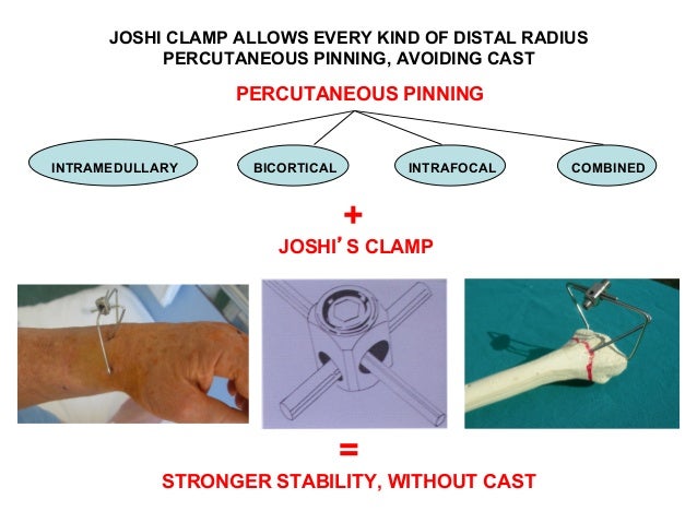Percutaneous Pinning