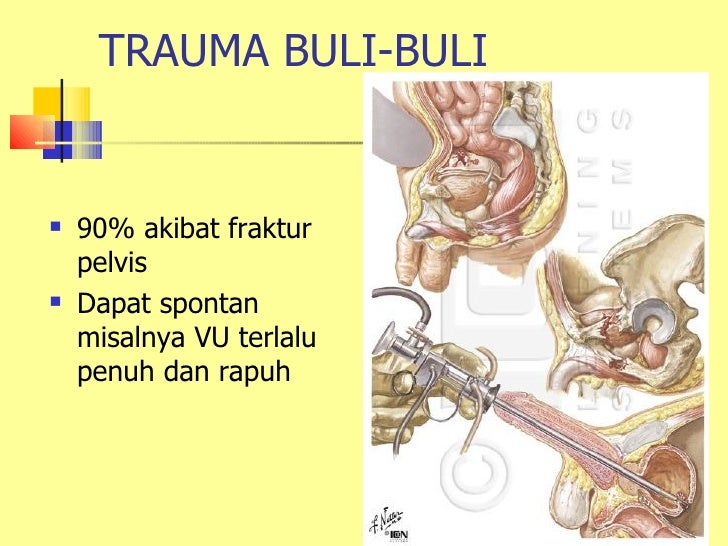Dr.adam trauma urologi dan pelvis as