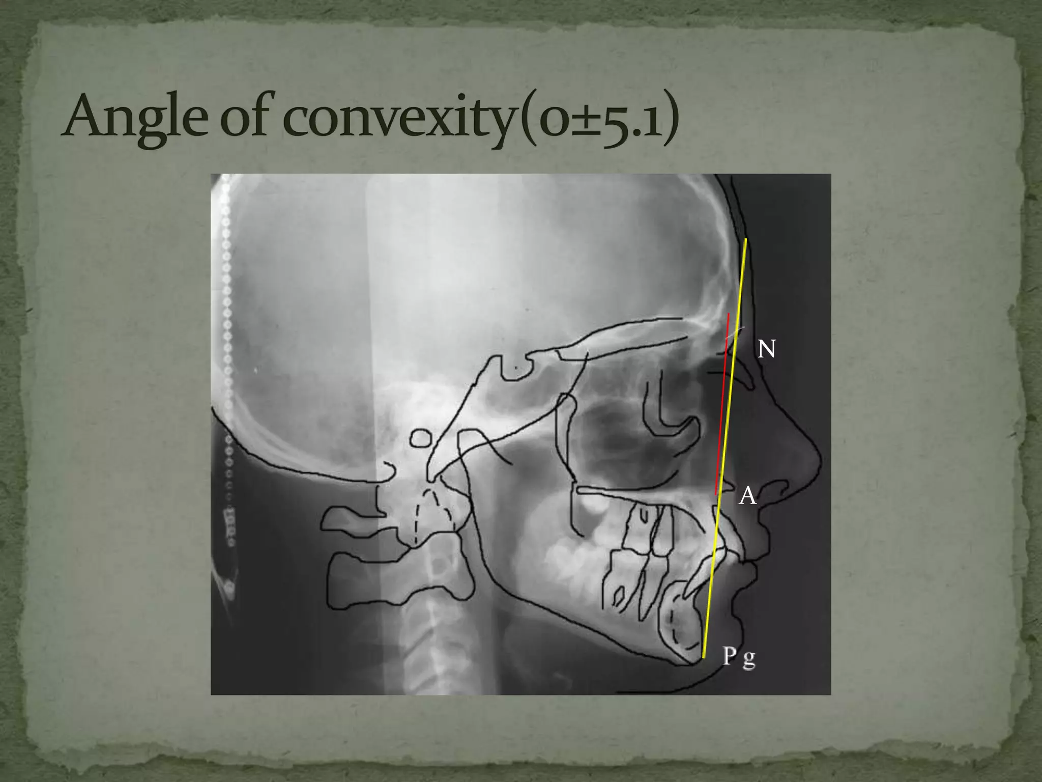 Downs analysis | PPTX