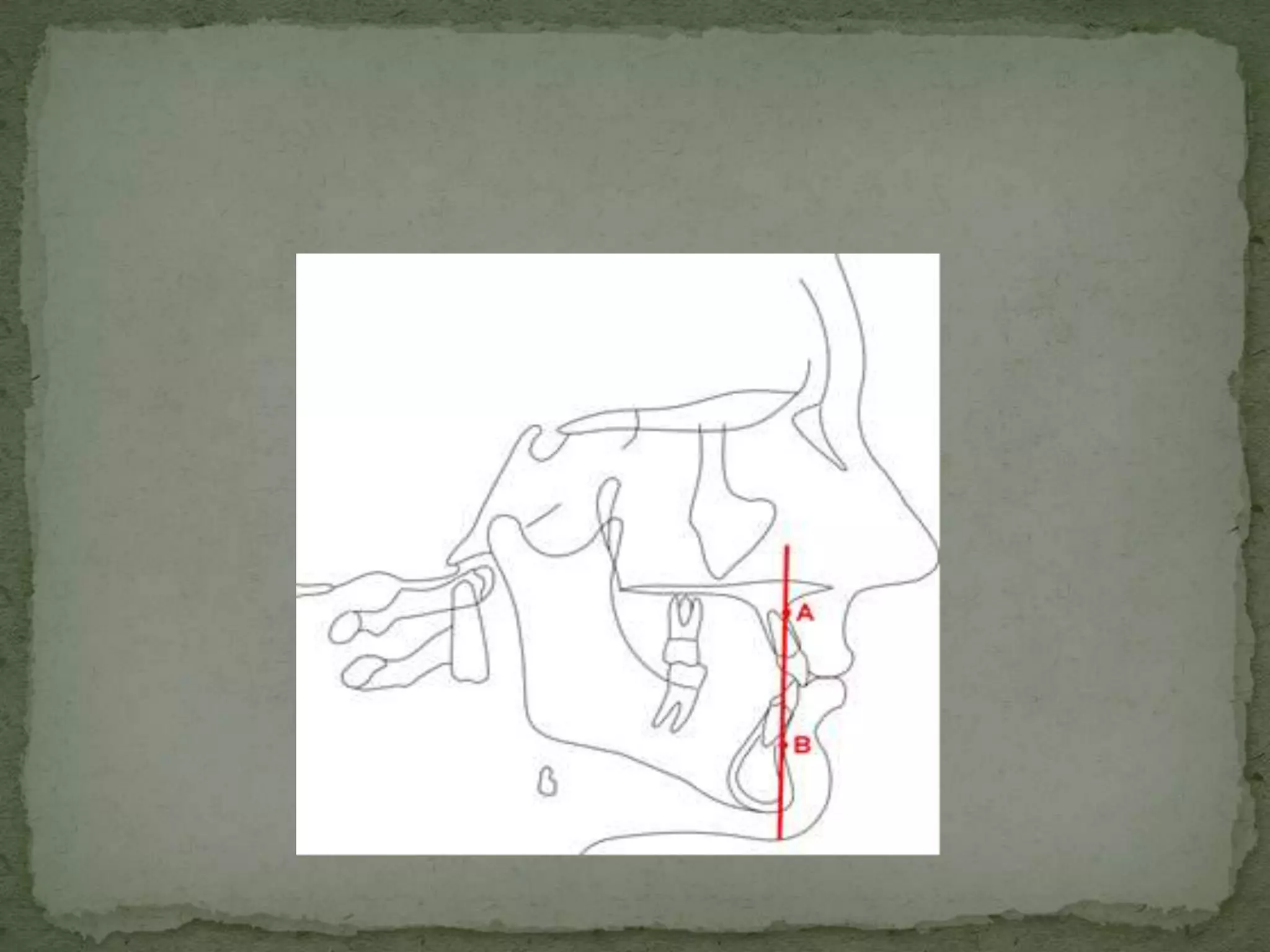 Downs analysis | PPTX