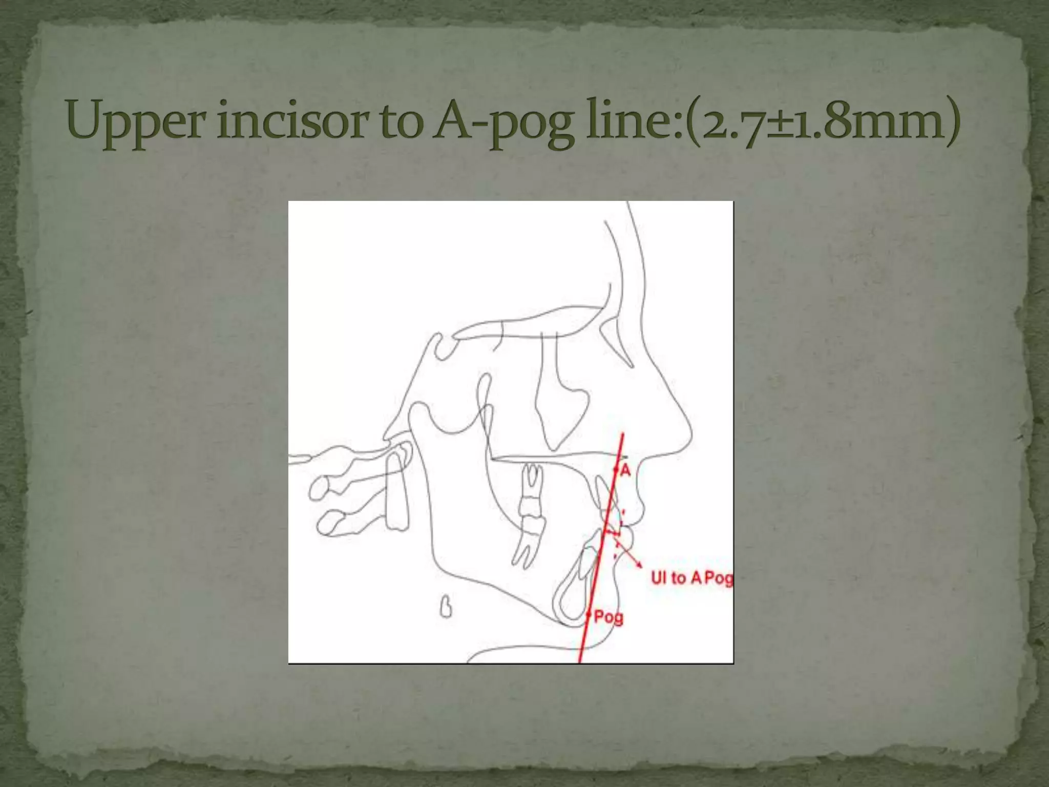 Downs analysis | PPTX