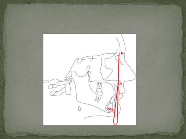 Downs analysis | PPTX