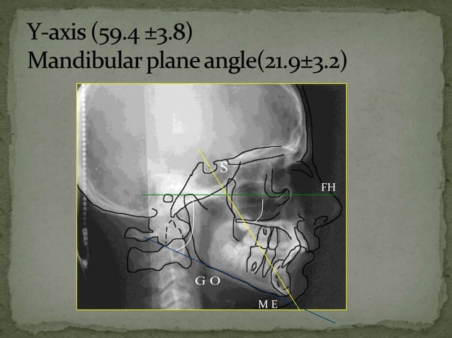 Downs analysis | PPTX