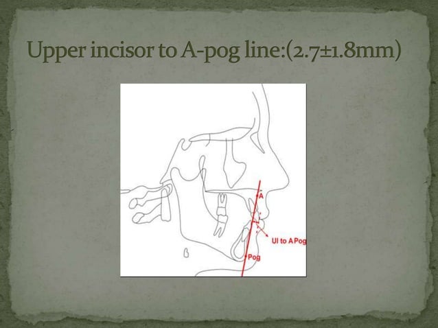 Downs analysis | PPTX