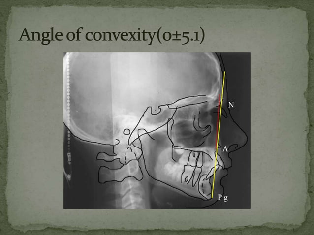 Downs analysis | PPT