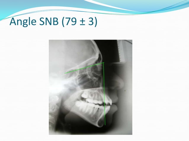 Steiners analysis | PPTX | Dental Health | Diseases and Conditions