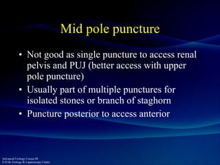 PCNL - the Perfect Puncture | PPT
