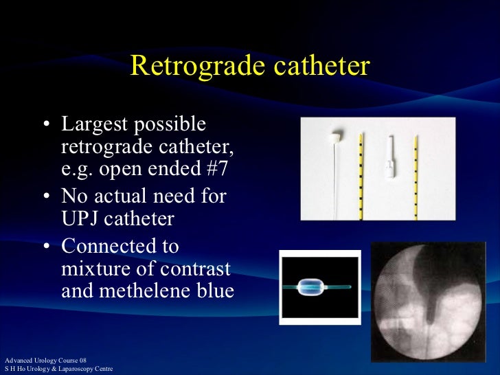 PCNL - the Perfect Puncture