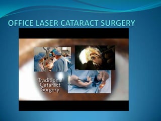 Catalys Office Laser Cataract Surgery | PPT