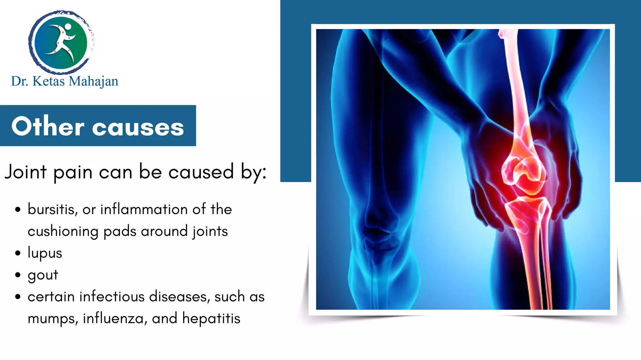 What to Know About Joint Pain? | PPT