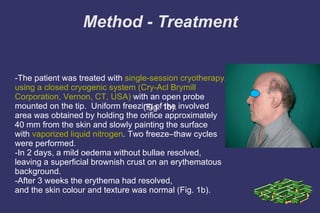 Case 1. Depigmentation therapy in vitiligo universalis with cryotherapy ...