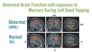 Dr. Meliones Presentation | PPTX