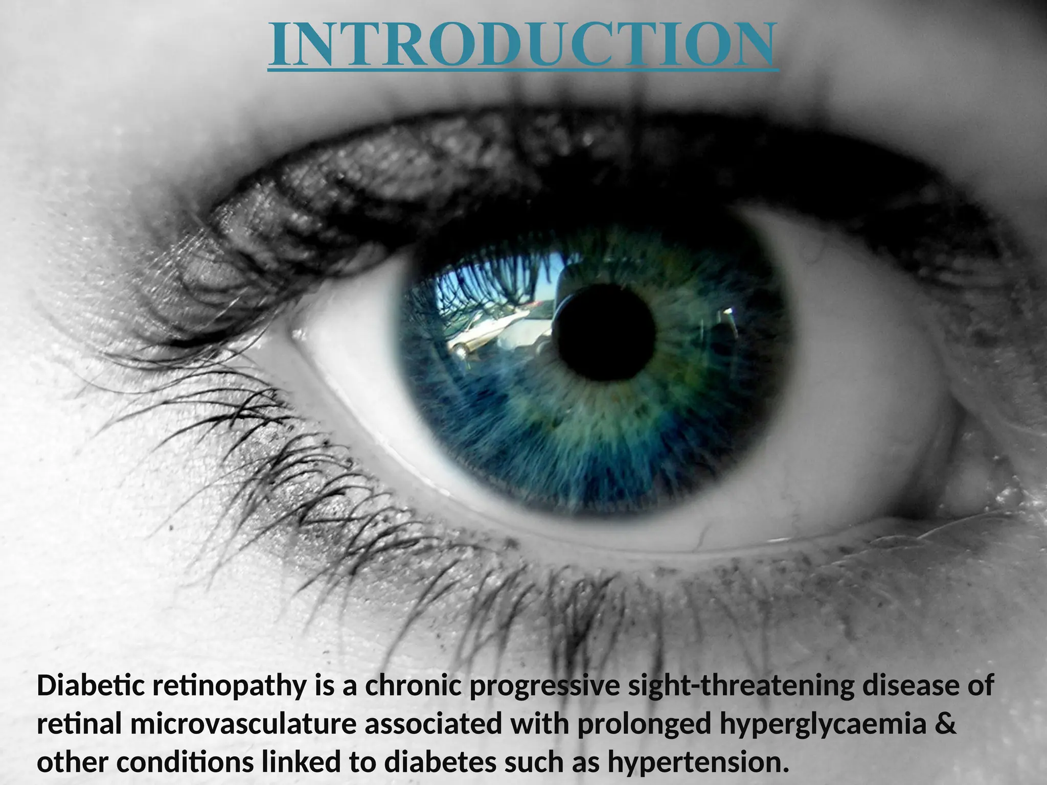 dr-Moks Diabetic Retinopathy (Ophthalmology).pptx
