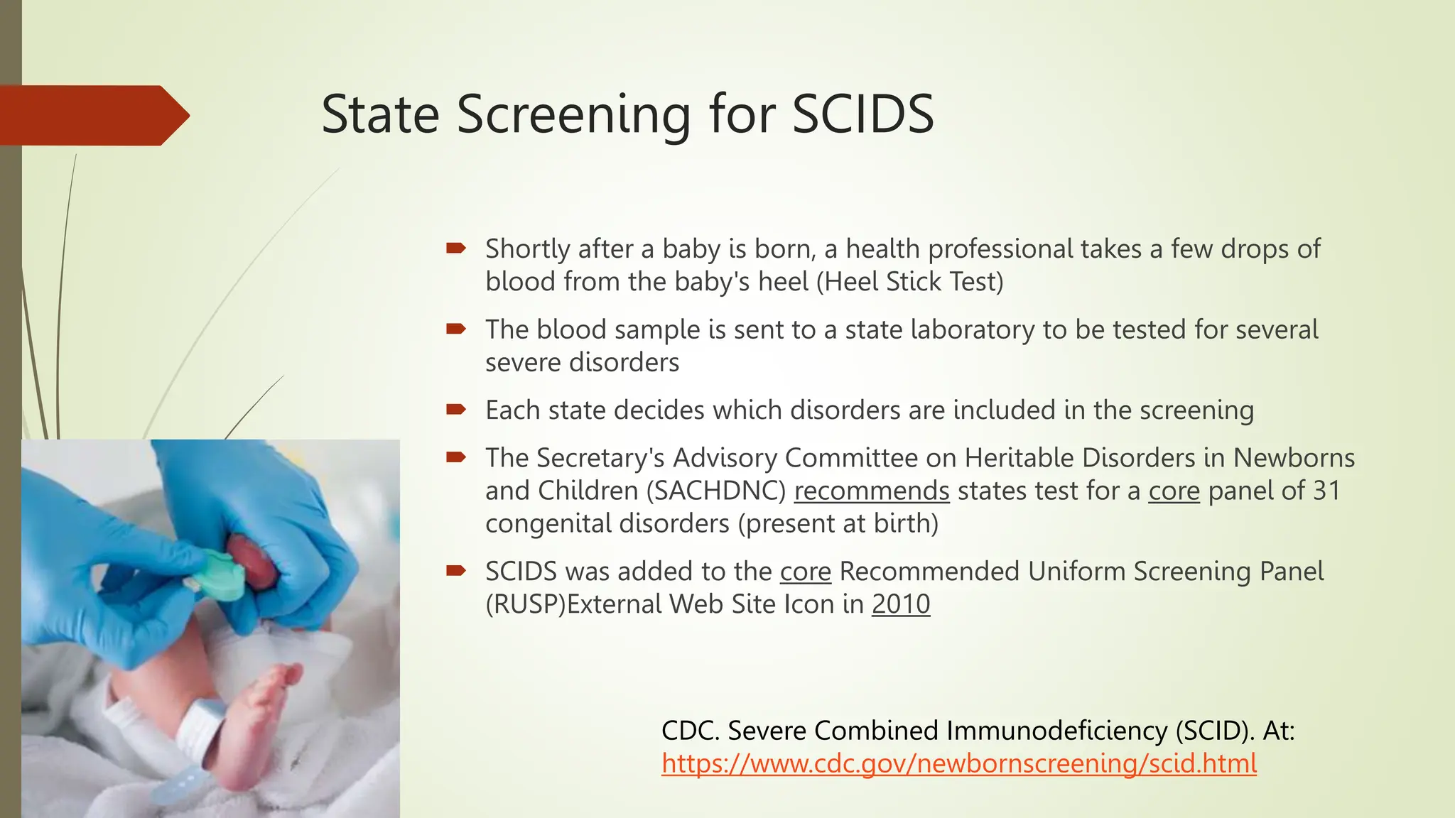dr-molina-scid-presentation.pptx for newborn screening | PPT