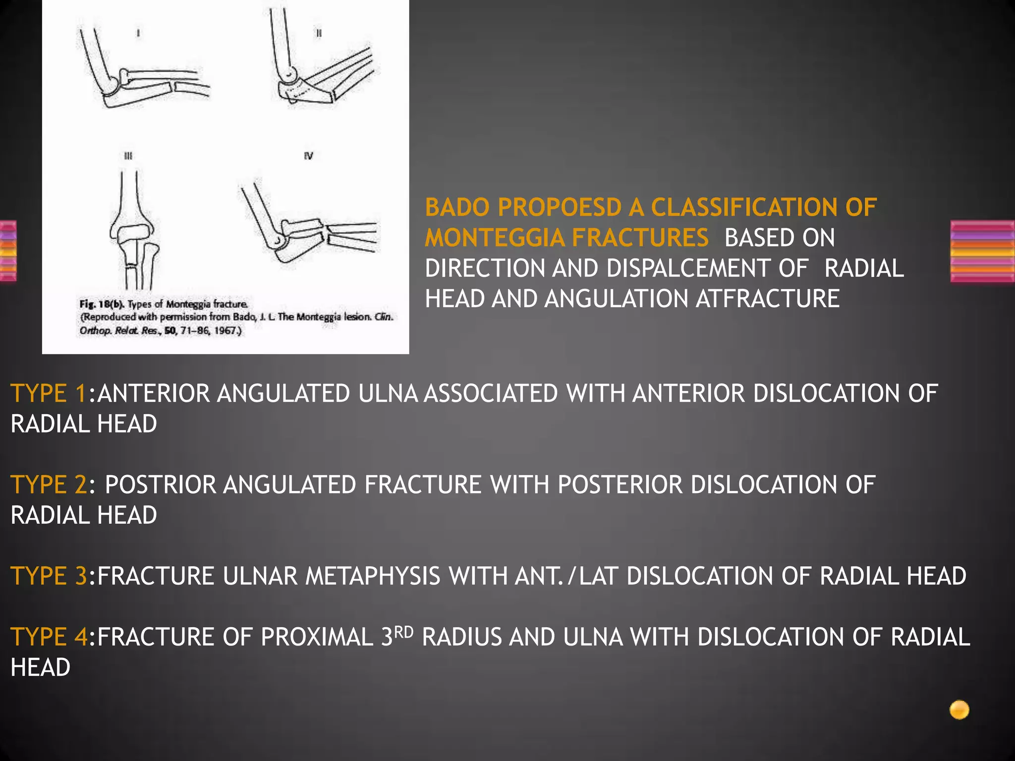 Dr. ms goud management of forearm fractures | PPTX