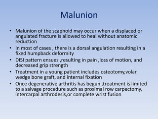 Dr. nagamunindrudu fractures of scaphoid | PPTX