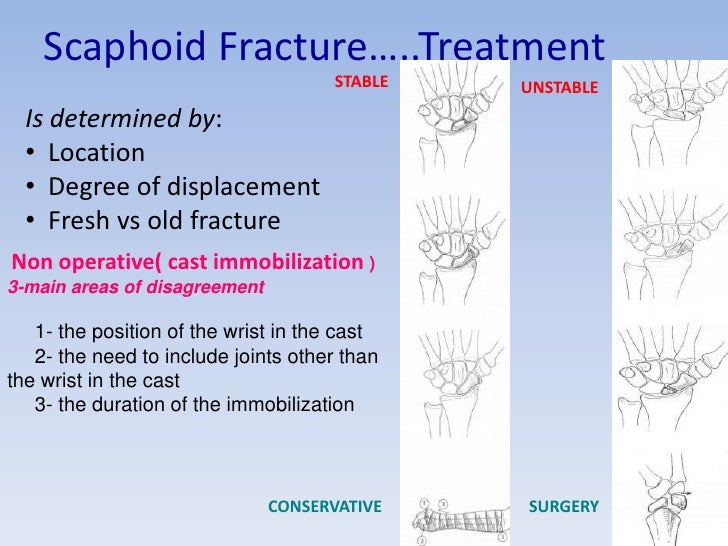 Dr. nagamunindrudu fractures of scaphoid