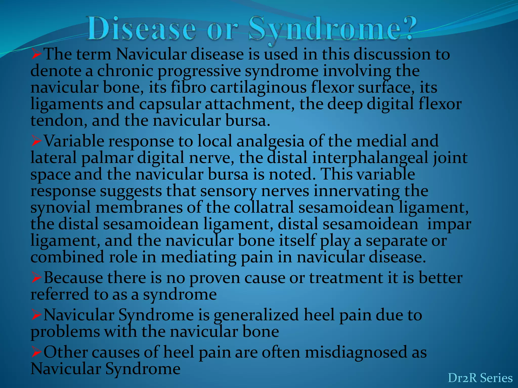 Dr rahimzadeh-navicular syndrome | PPTX