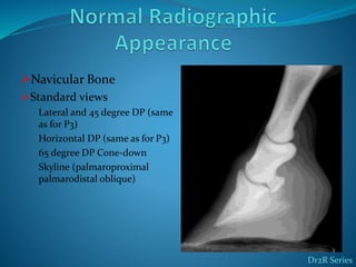 Dr rahimzadeh-navicular syndrome | PPTX