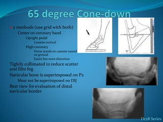 Dr rahimzadeh-navicular syndrome | PPTX