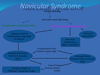 Dr rahimzadeh-navicular syndrome | PPTX