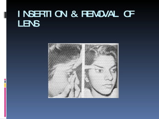 Hard Contact Lenses | PPT