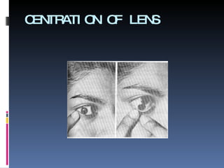 Hard Contact Lenses | PPT