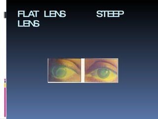 Hard Contact Lenses | PPT