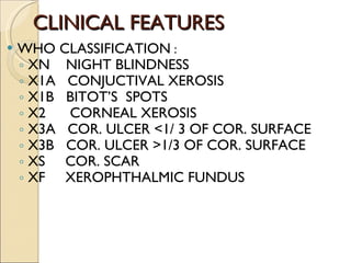 Vitamin A Deficiency & Eye | PPT