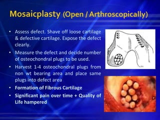 Knee Cartilage surgery in India | PPT