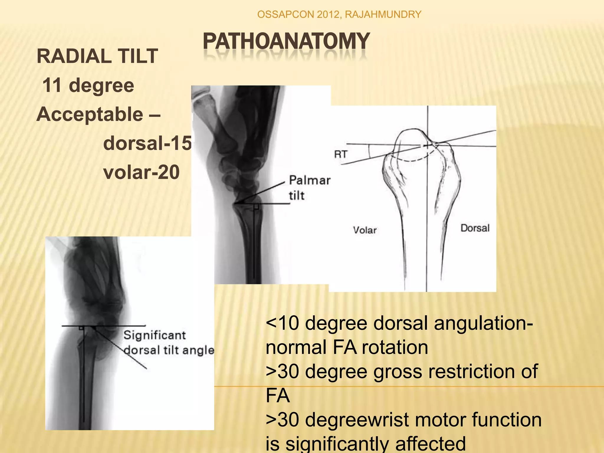 Dr.y.nageshwarao neglected wrist fractures | PPTX