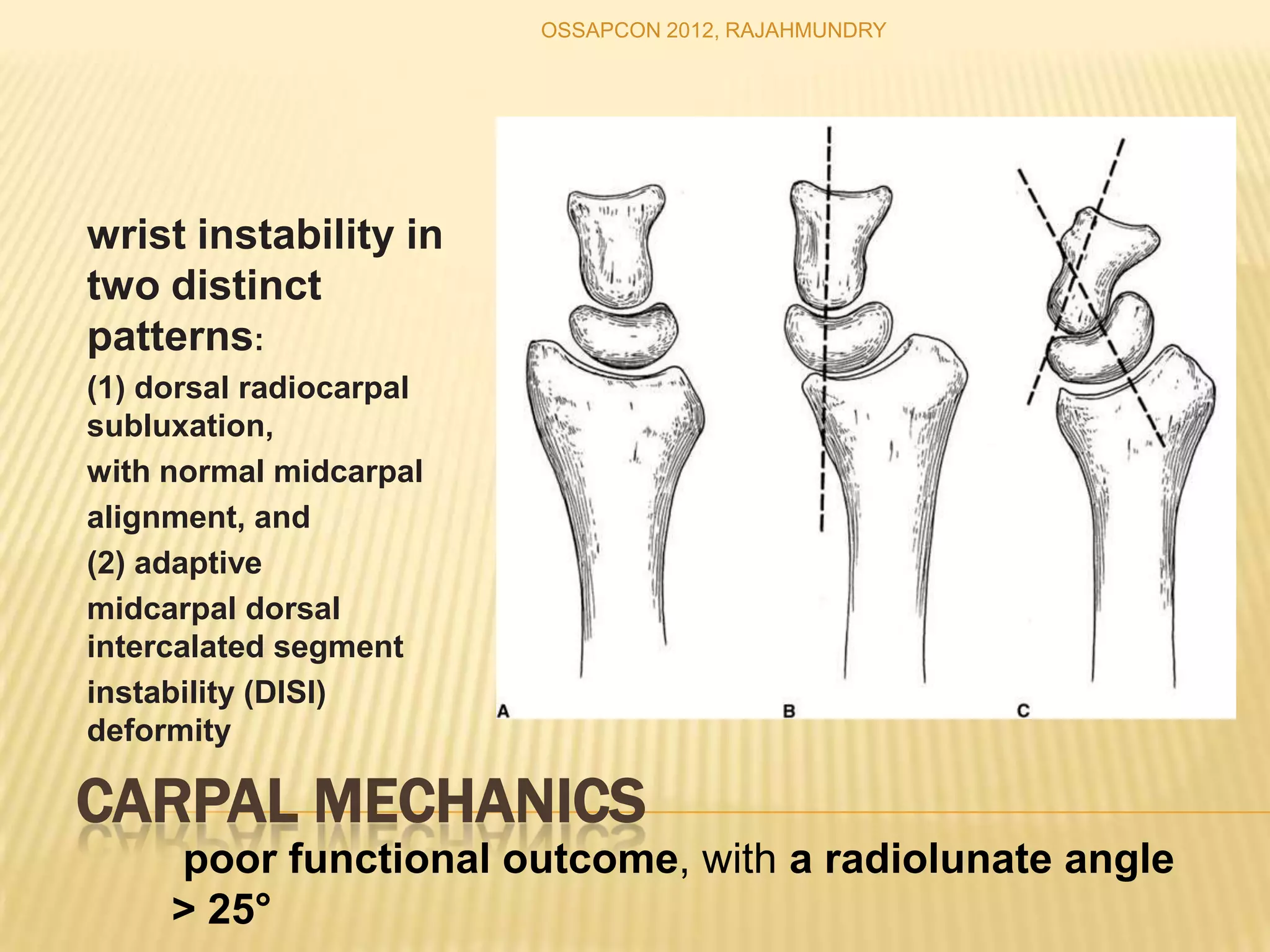 Dr.y.nageshwarao neglected wrist fractures | PPTX