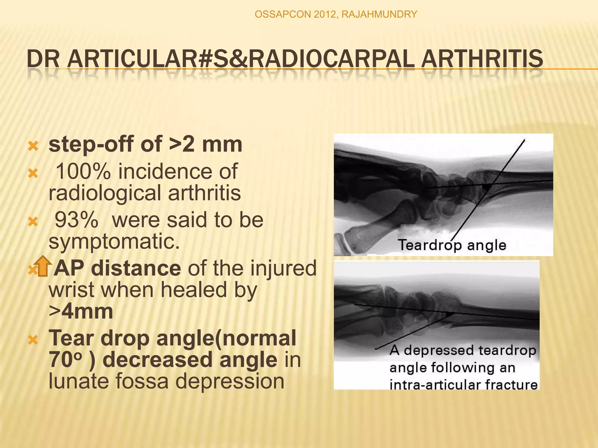 Dr.y.nageshwarao neglected wrist fractures | PPTX