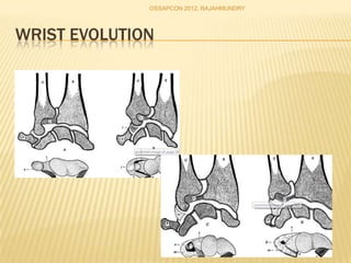 Dr.y.nageshwarao neglected wrist fractures | PPTX