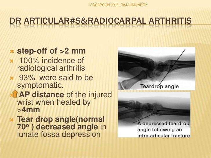 Dr.y.nageshwarao neglected wrist fractures