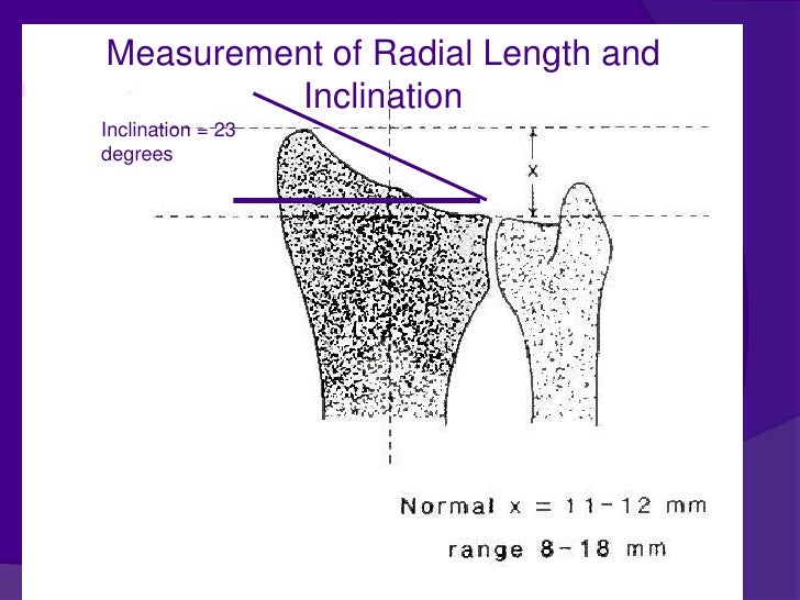 Dr. yt reddy distal radius fractures modified