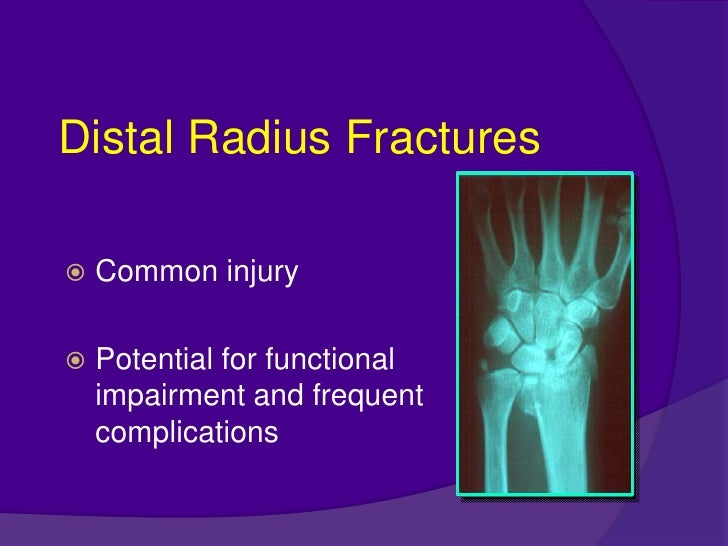 Dr. yt reddy distal radius fractures modified