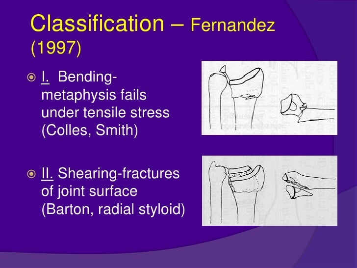 Dr. yt reddy distal radius fractures modified