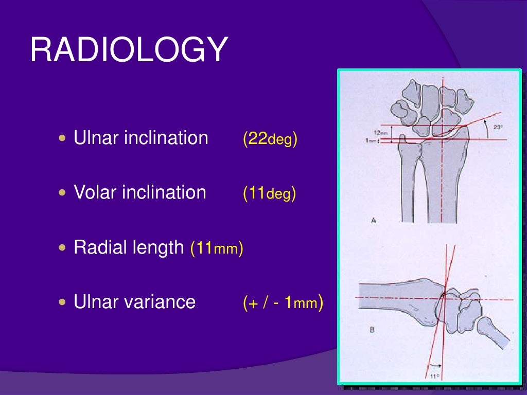 Dr. yt reddy distal radius fractures modified