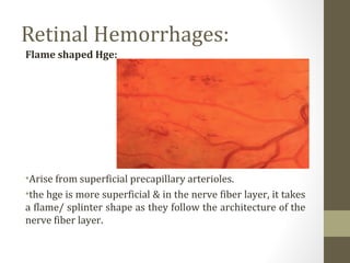 Diabetic Retinopathy | PPT