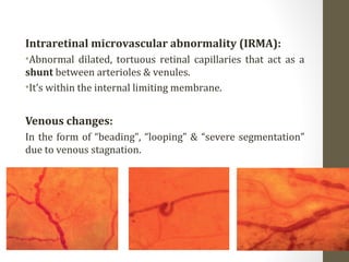 Diabetic Retinopathy | PPT
