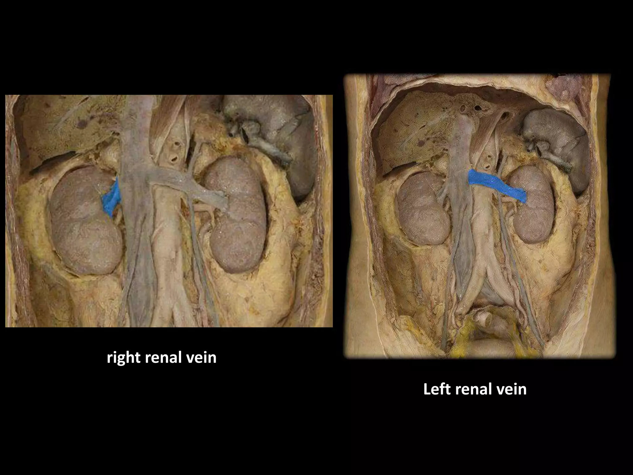 Dóra-Dávid-Anatomy-of-the-kidney-ureter-and-bladder-2018.pptx