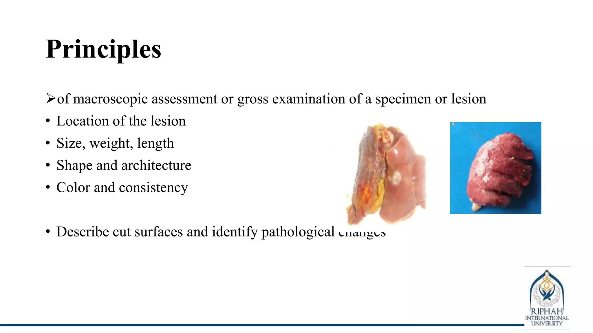 Gross Examination, Selection, Collection and Fixation of Specimen | PPTX