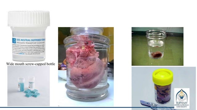 Gross Examination, Selection, Collection and Fixation of Specimen | PPTX