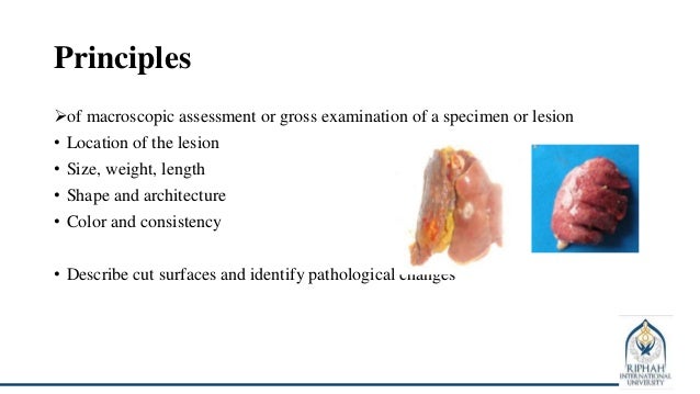 Gross Examination, Selection, Collection and Fixation of Specimen