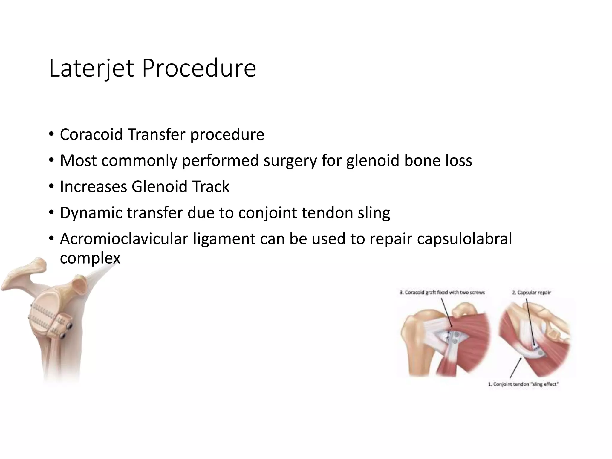 shoulder injuries.pptx