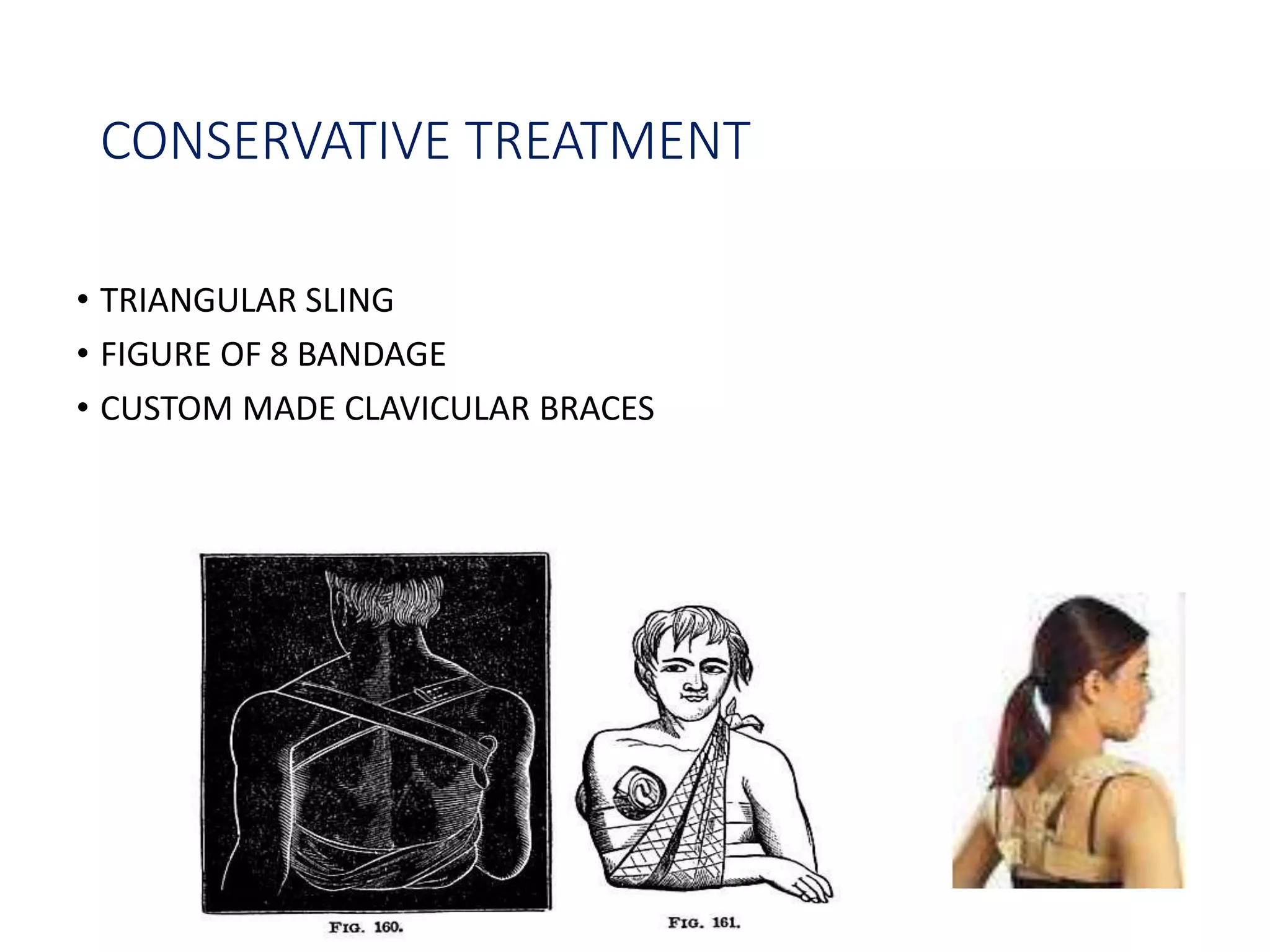 shoulder injuries.pptx