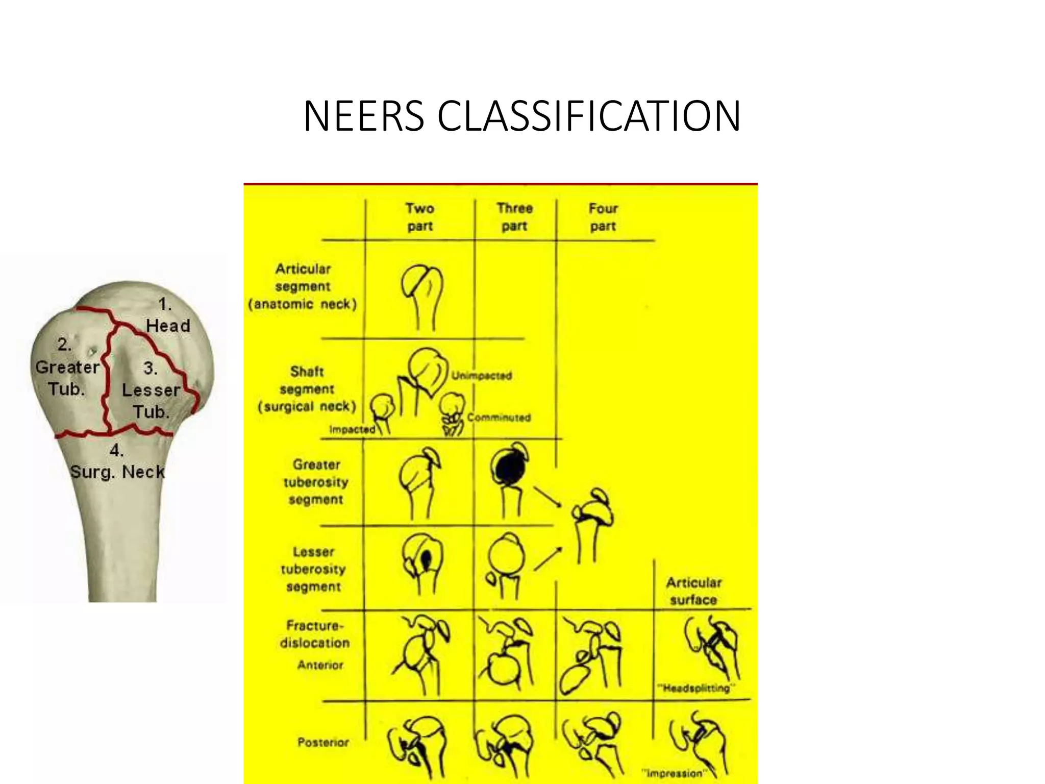 shoulder injuries.pptx